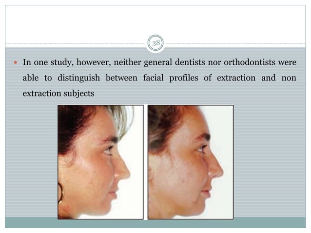 Extraction Vs non exraction in orthodontics.pptx