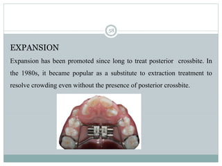 Extraction Vs non exraction in orthodontics.pptx