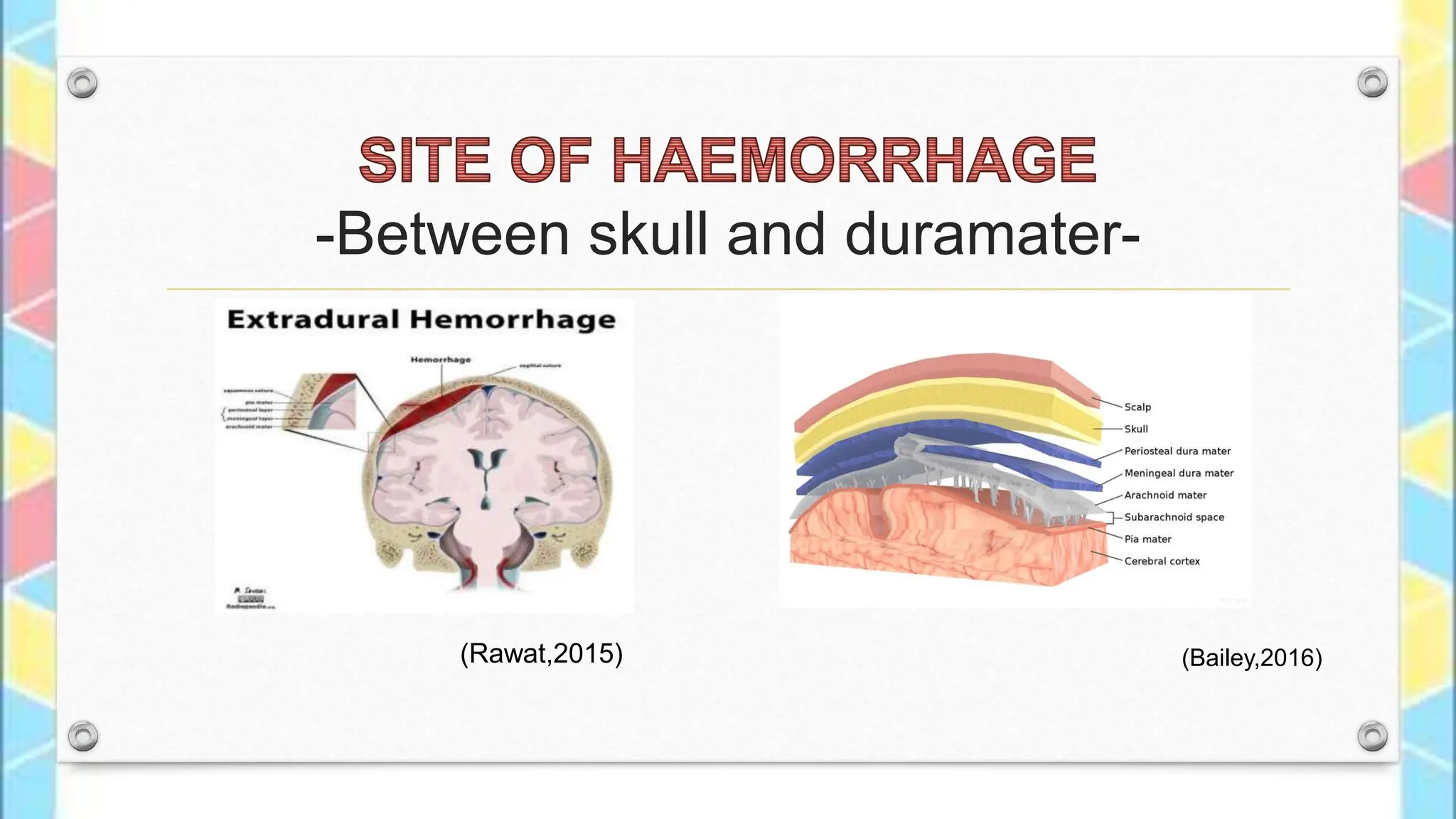 Extradural HAEMORRHAGE (i-learn) CNS System | PPTX