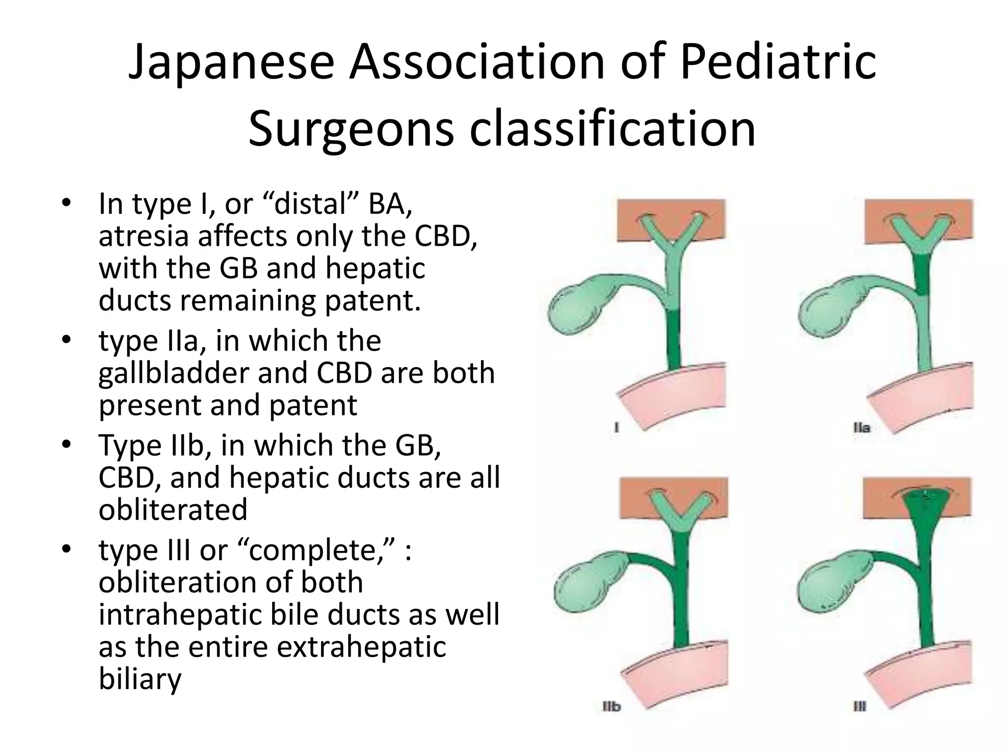 Extrahepatic biliary atresia | PPTX