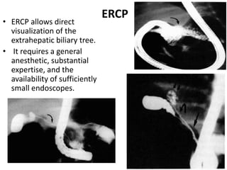 Extrahepatic biliary atresia | PPT