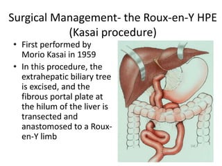 Extrahepatic biliary atresia | PPT