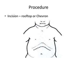 Extrahepatic biliary atresia | PPT