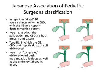Extrahepatic biliary atresia | PPT