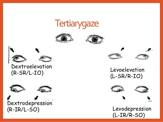 Extraocular muscles