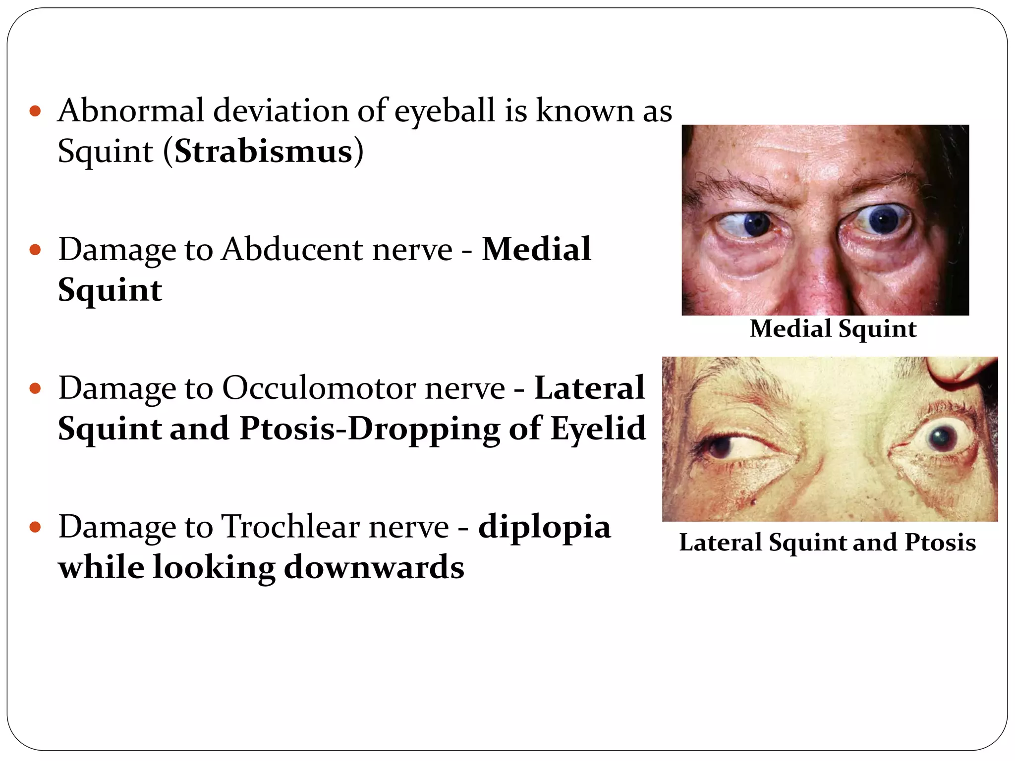 Extraocularmuscles 160315042629 | PDF