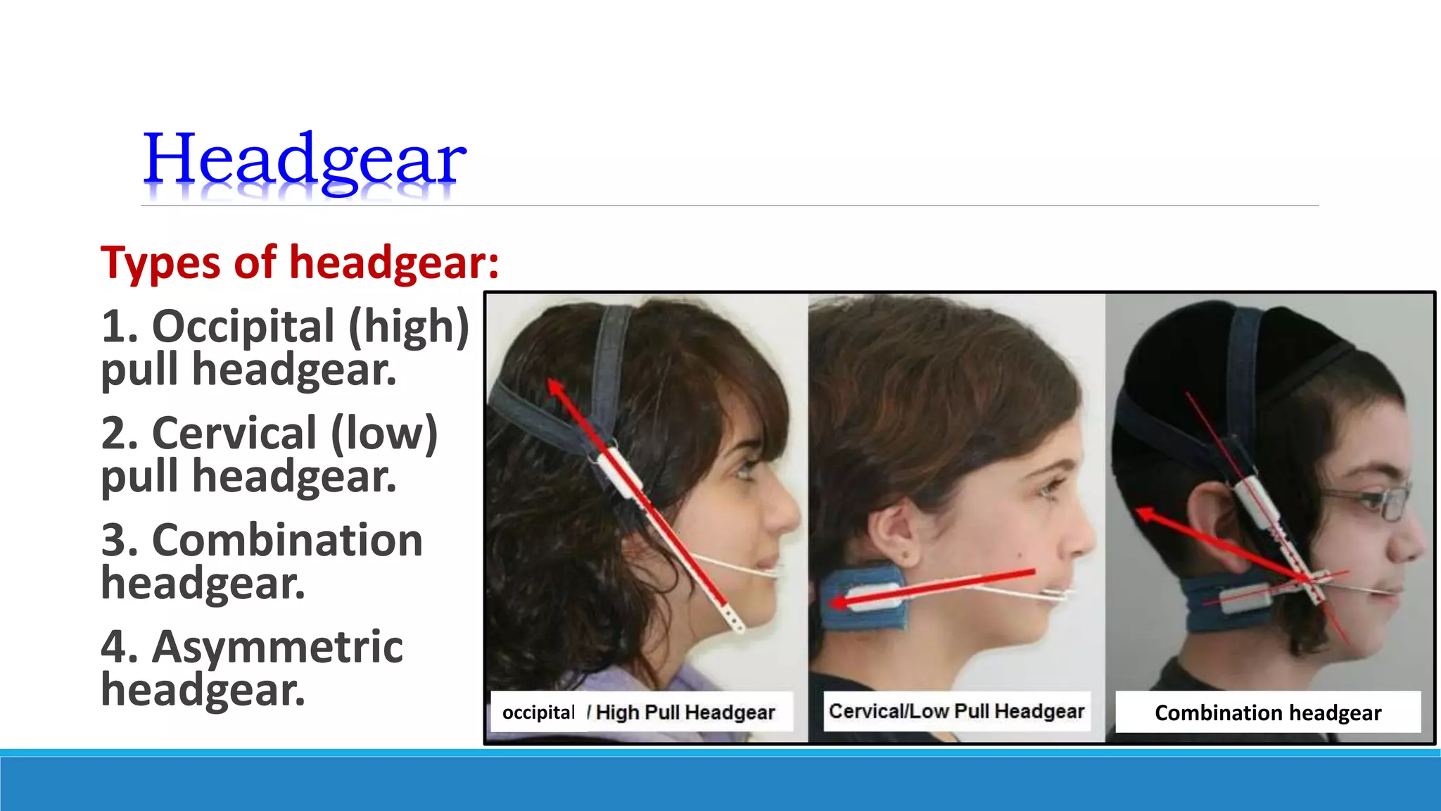 Extraoral appliances | PPTX