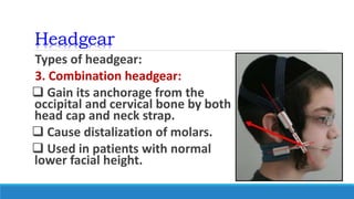 Extraoral appliances | PPTX