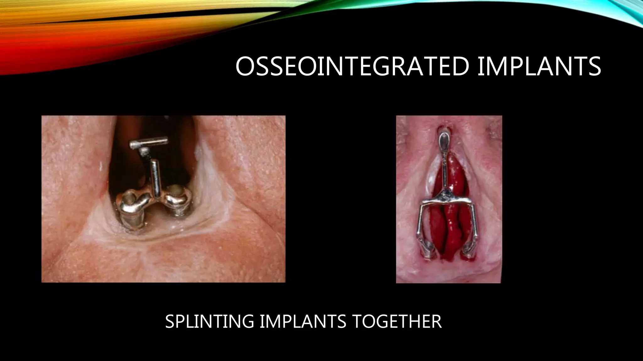 Extra oral defects | PPTX