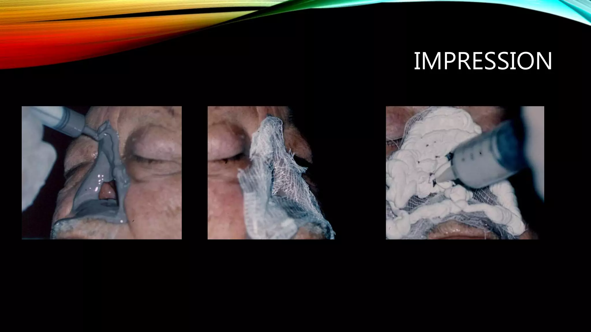 Extra oral defects | PPTX