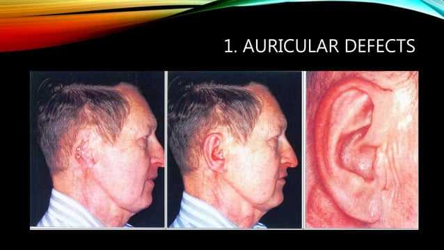 Extra oral defects | PPTX