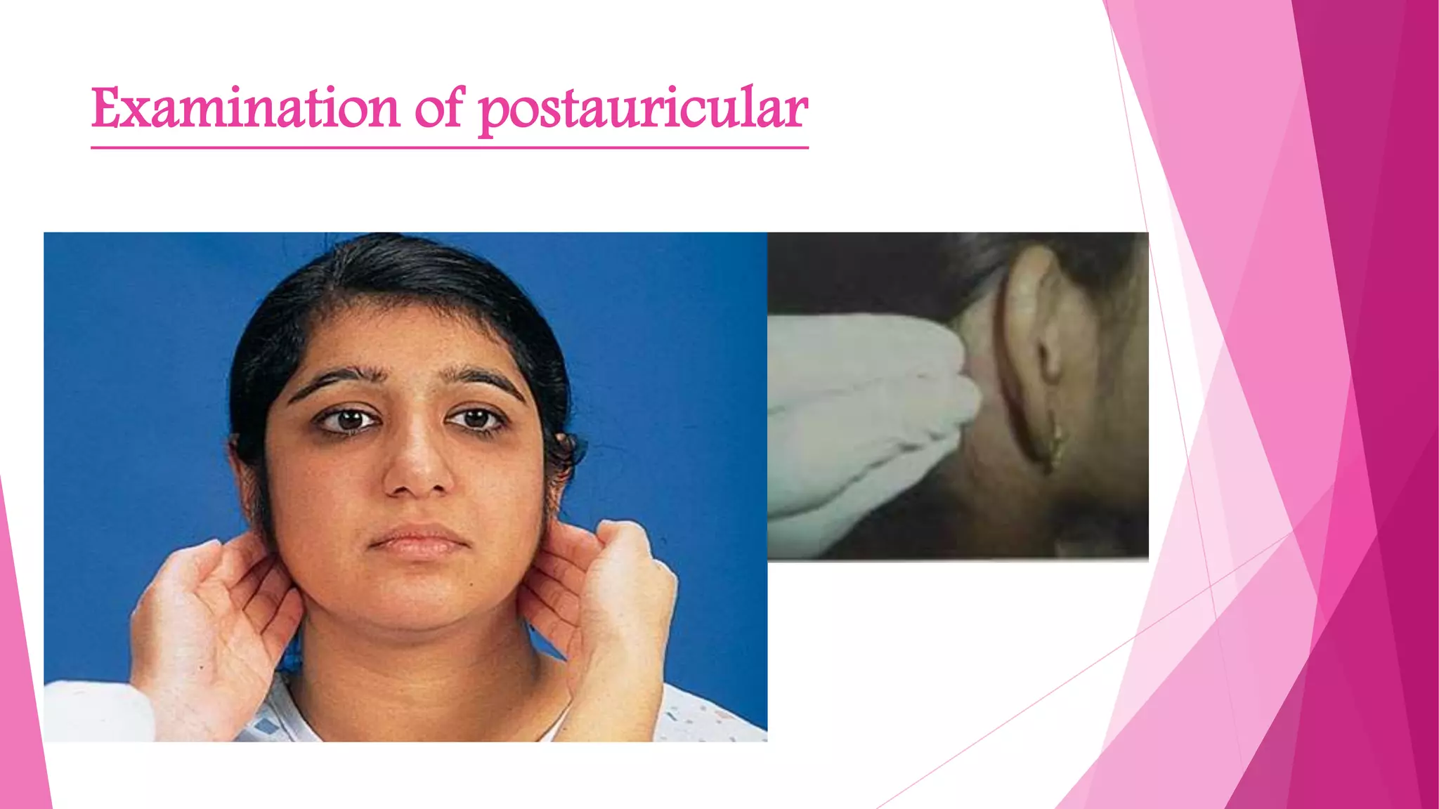 Extraoral examination | PPTX