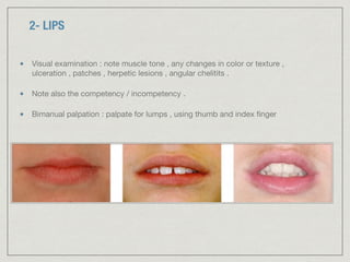 Extraoral examination | PPT