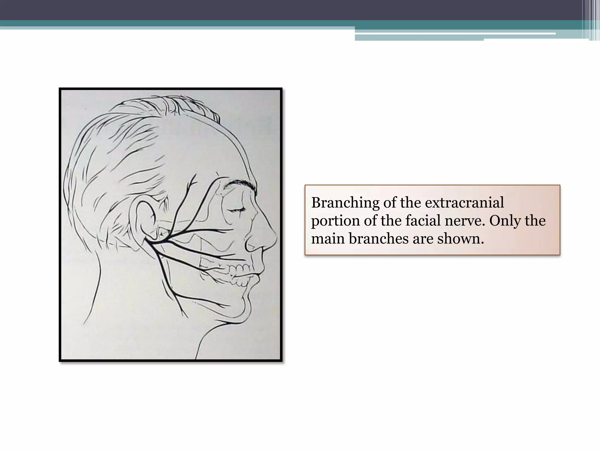 Extraoral mandibular approaches | PPTX