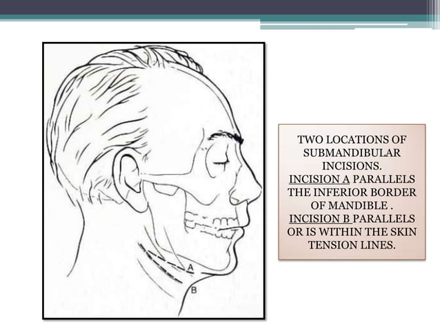 Extraoral mandibular approaches | PPTX | Ear, Nose and Throat ...