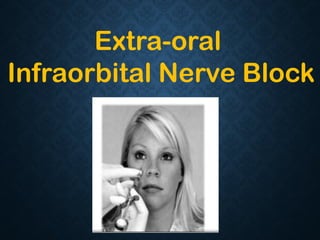 EXTRA ORAL NERVE BLOCKS-1 for maxillary and mandibulkar anaesthesia.pptx