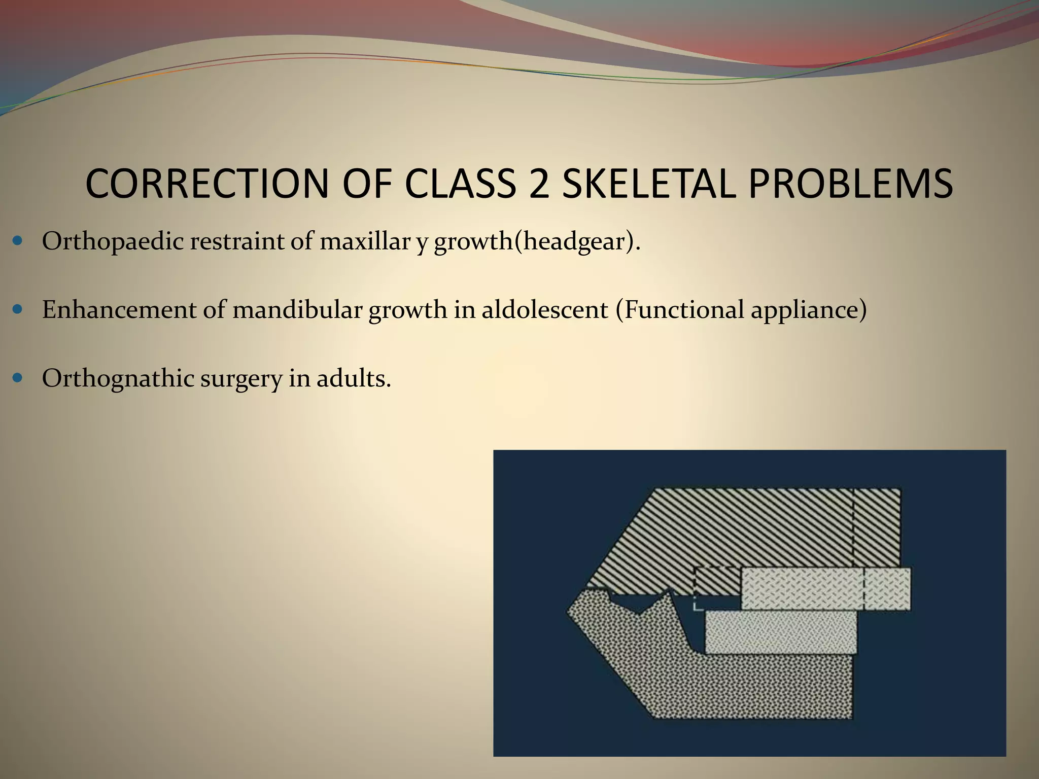 Extraoral orthopaedic appliance(headgear) | PPTX