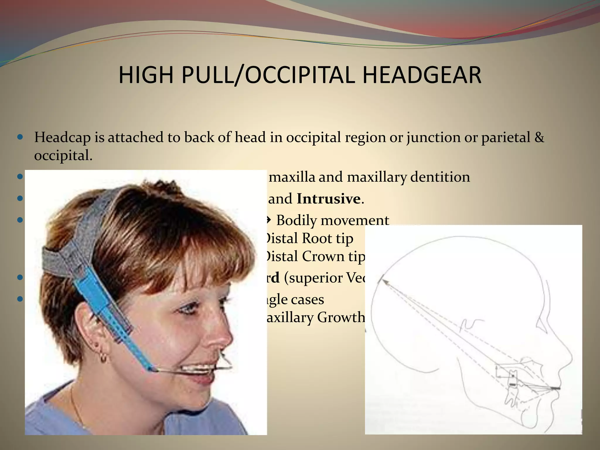 Extraoral orthopaedic appliance(headgear) | PPTX