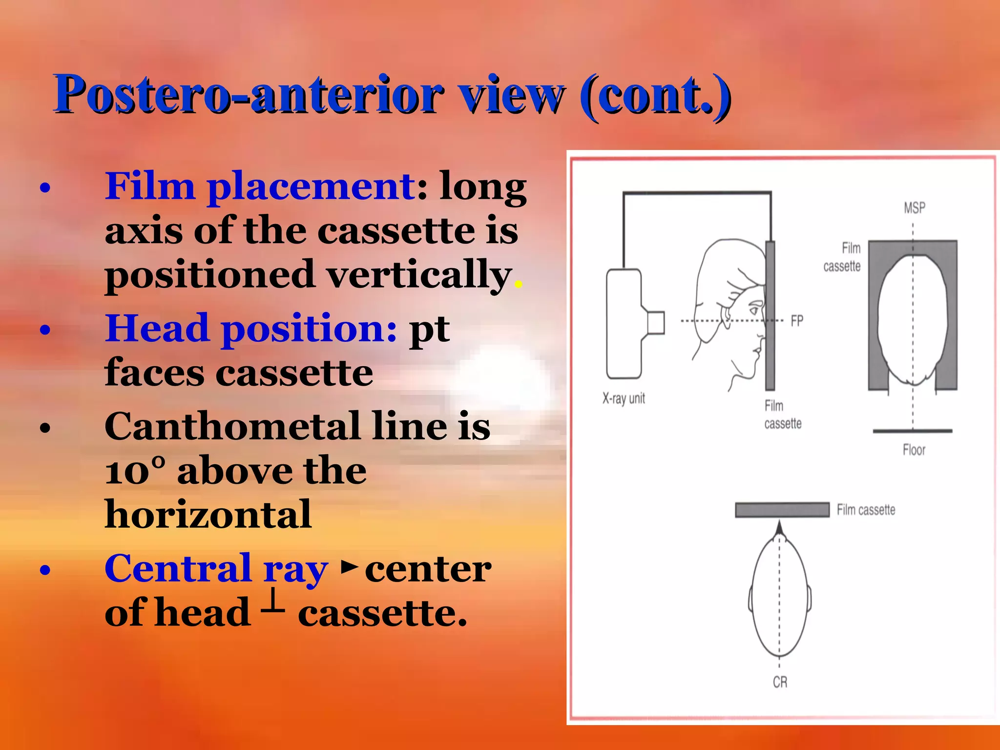 Extra-oral Radiology Techniques II | PPT