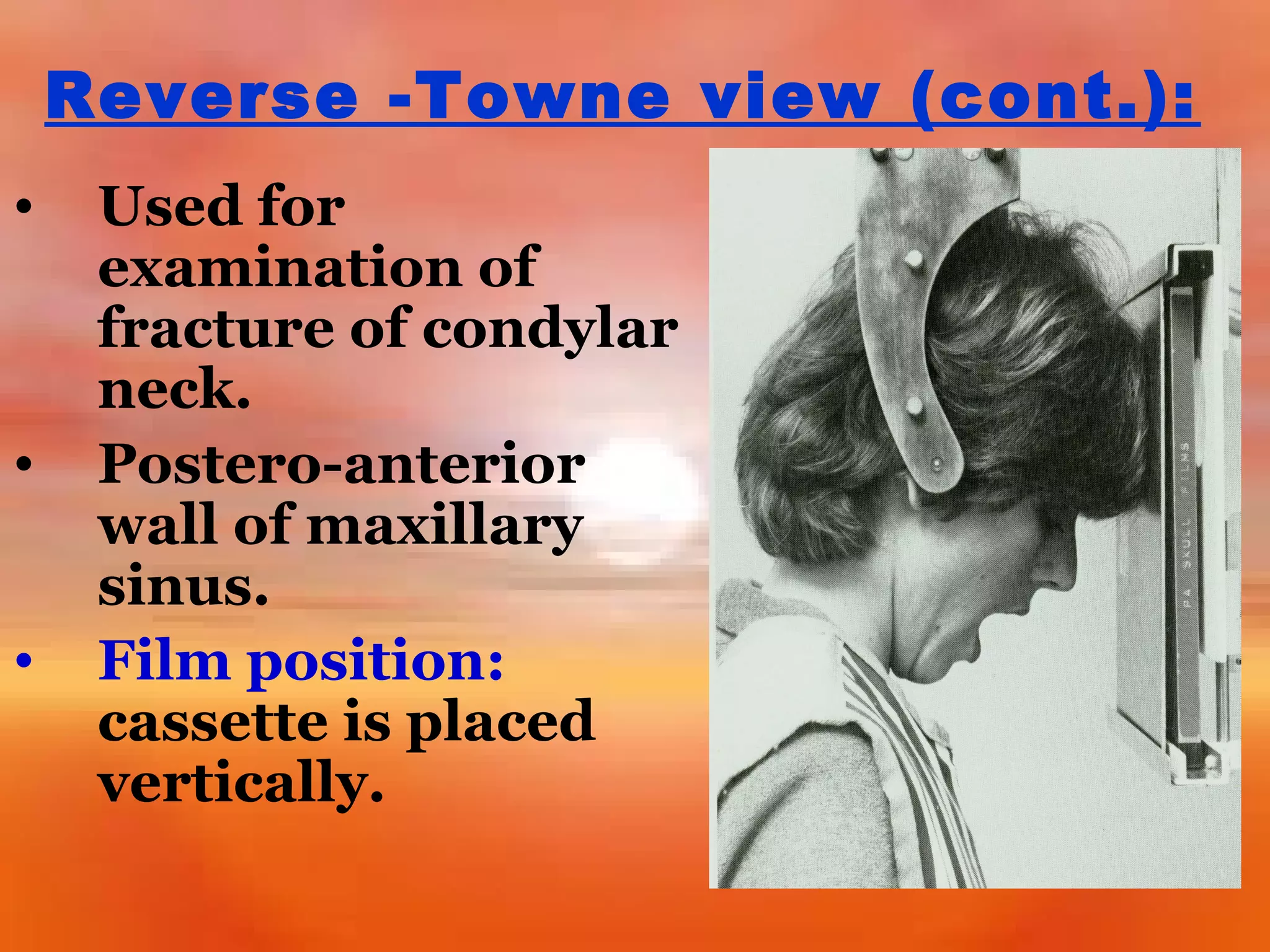 Extra-oral Radiology Techniques II | PPT