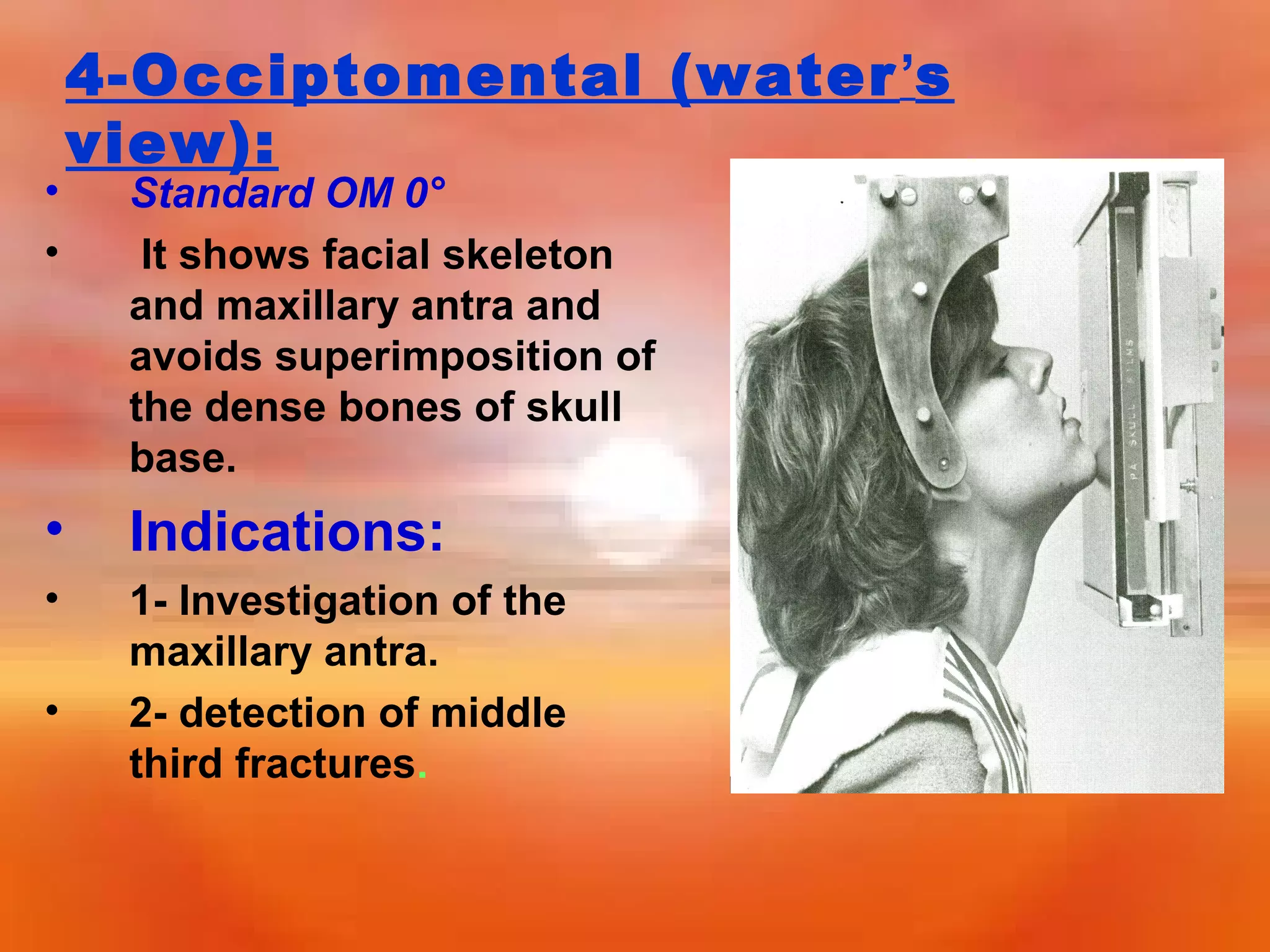 Extra-oral Radiology Techniques II | PPT