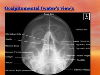 Extra-oral Radiology Techniques II | PPT