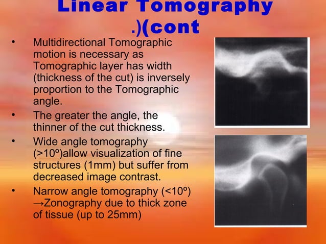 Extra Oral Radiology Techniques Ii