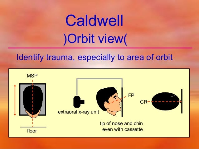 Extra-oral Radiology Techniques II