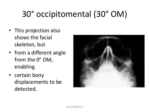 Extra oral radiograph