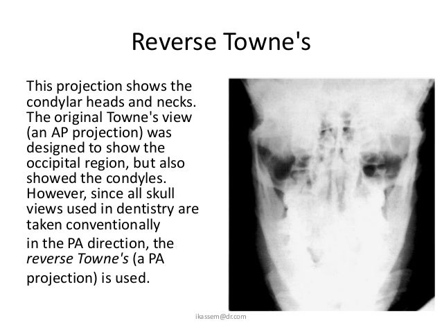 Extra oral radiograph