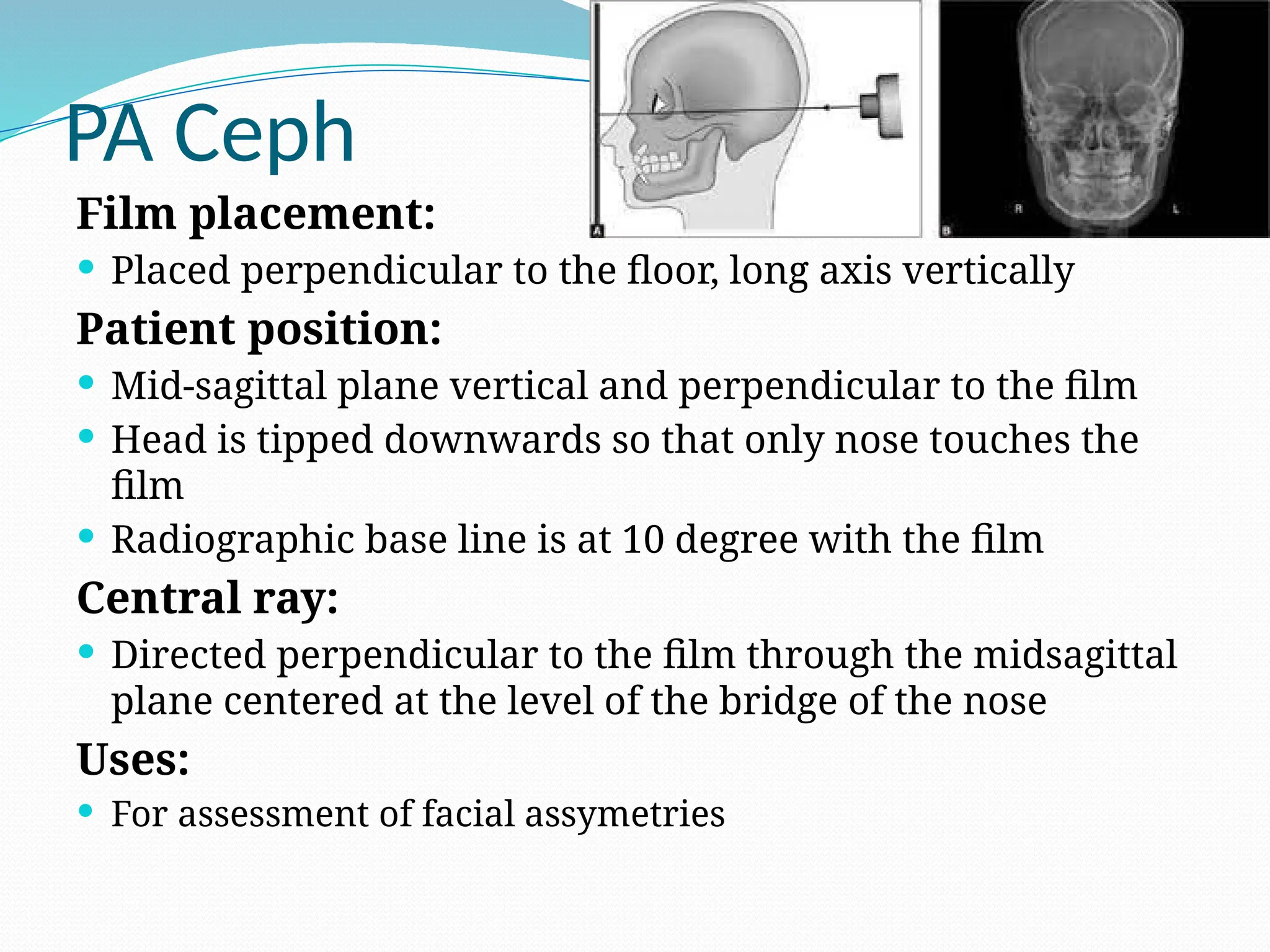 Extra oral radiographic techniques-Dr Joseph Johny.pptx