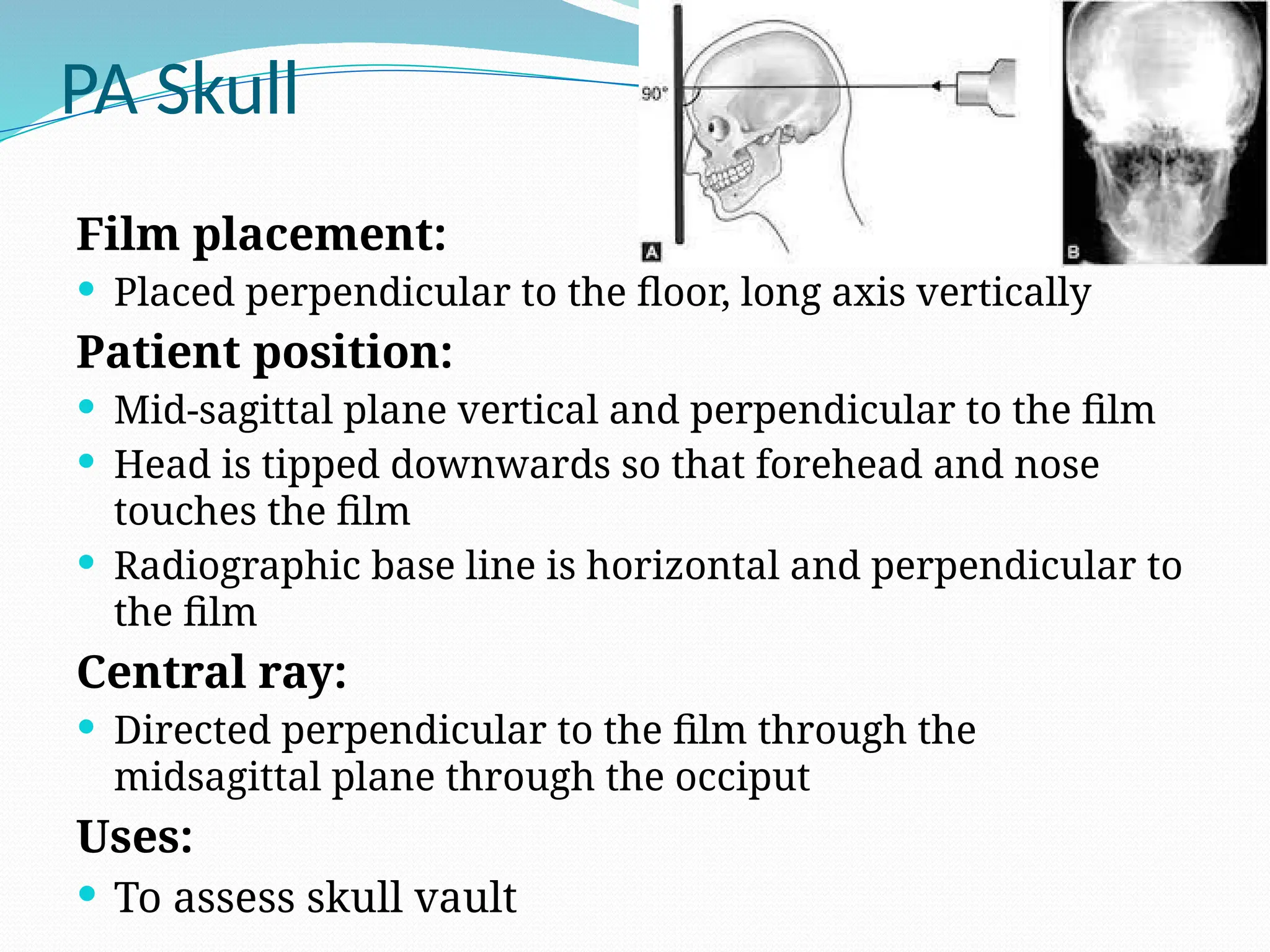 Extra oral radiographic techniques-Dr Joseph Johny.pptx