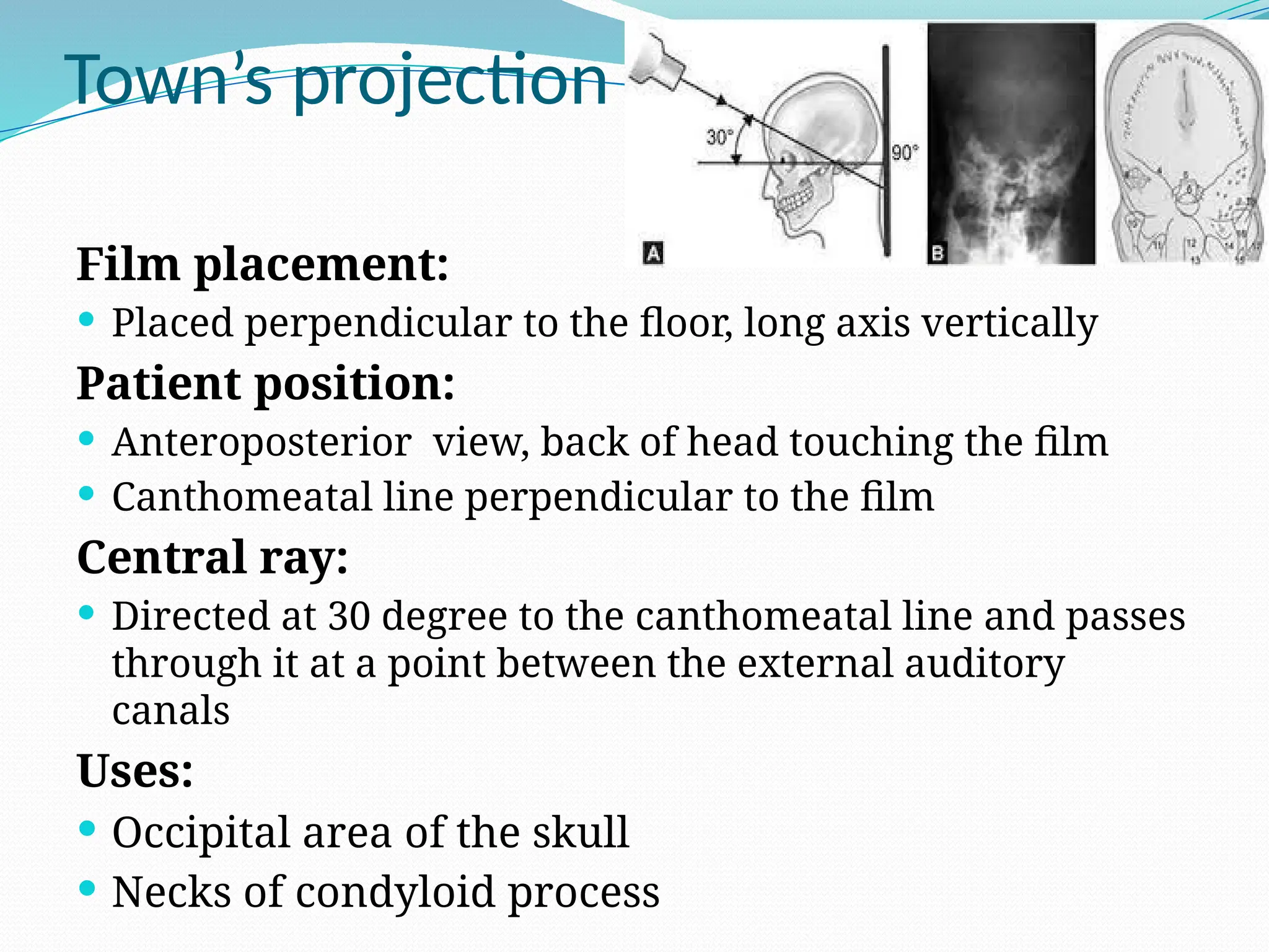 Extra oral radiographic techniques-Dr Joseph Johny.pptx
