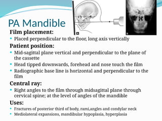 Extra oral radiographic techniques-Dr Joseph Johny.pptx