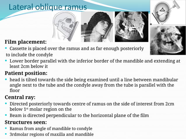 Extra oral radiographic techniques-Dr Joseph Johny.pptx | Free Download