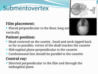 Extra oral radiographic techniques-Dr Joseph Johny.pptx