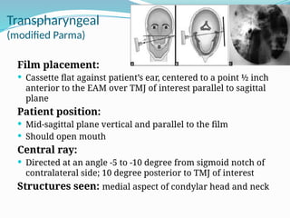 Extra oral radiographic techniques-Dr Joseph Johny.pptx