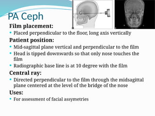 Extra oral radiographic techniques-Dr Joseph Johny.pptx