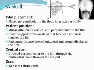 Extra oral radiographic techniques-Dr Joseph Johny.pptx