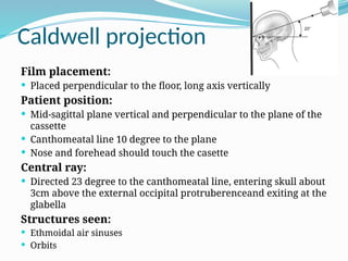 Extra oral radiographic techniques-Dr Joseph Johny.pptx