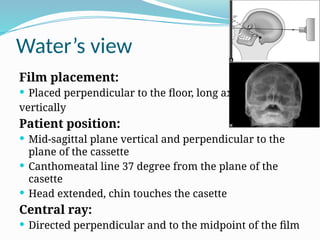 Extra oral radiographic techniques-Dr Joseph Johny.pptx