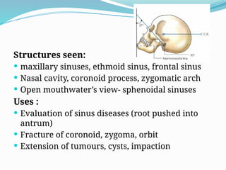 Extra oral radiographic techniques-Dr Joseph Johny.pptx