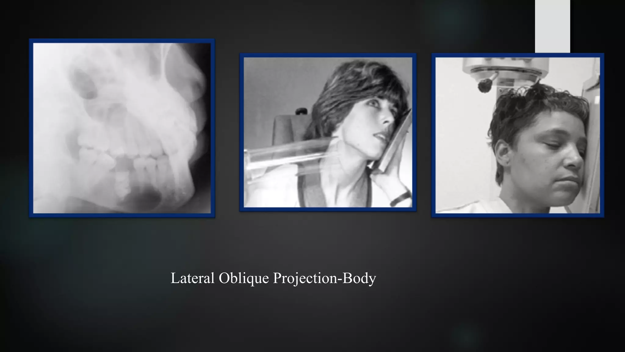Extraoral radiograph lecture | PPT