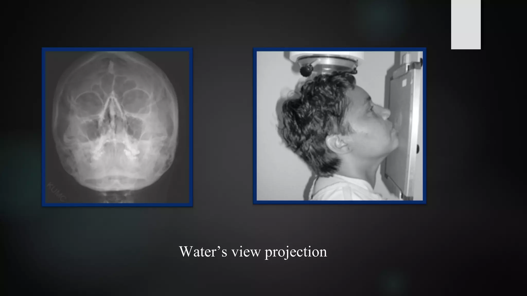 Extraoral radiograph lecture | PPT