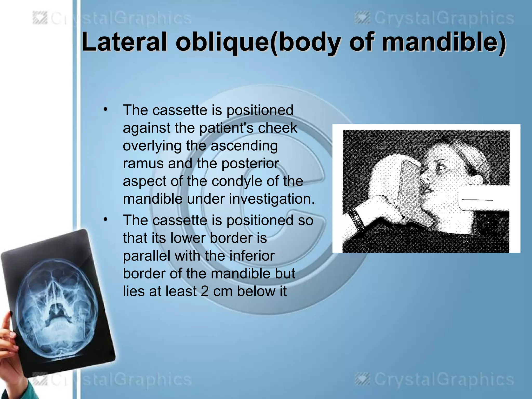 Extraoral radiography | PPT