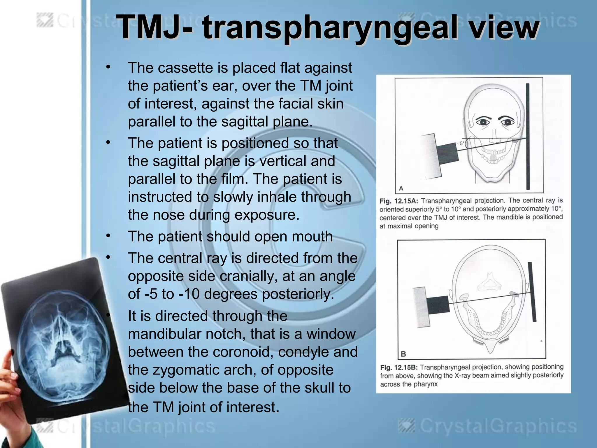 Extraoral radiography | PPT