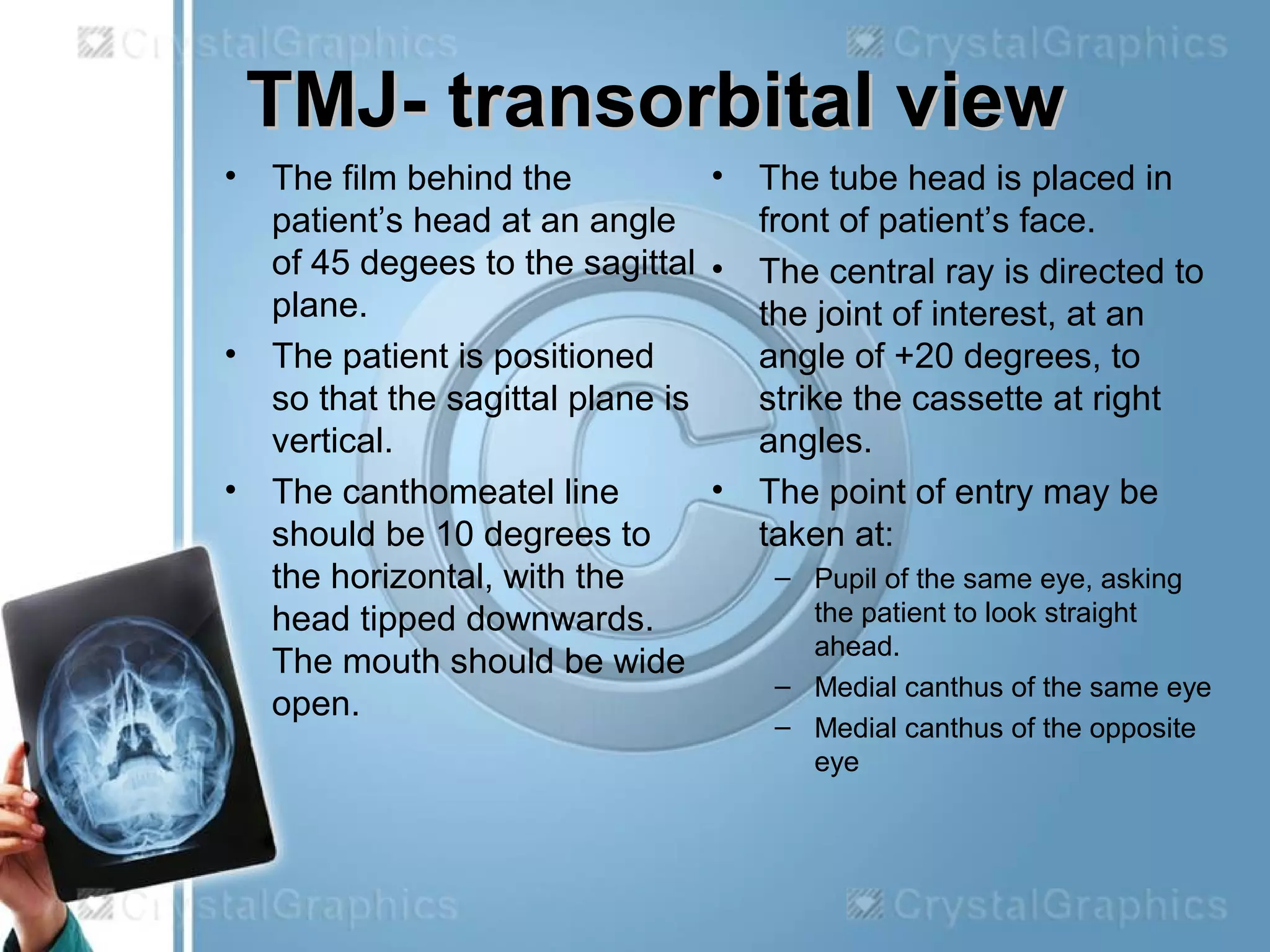 Extraoral radiography | PPT