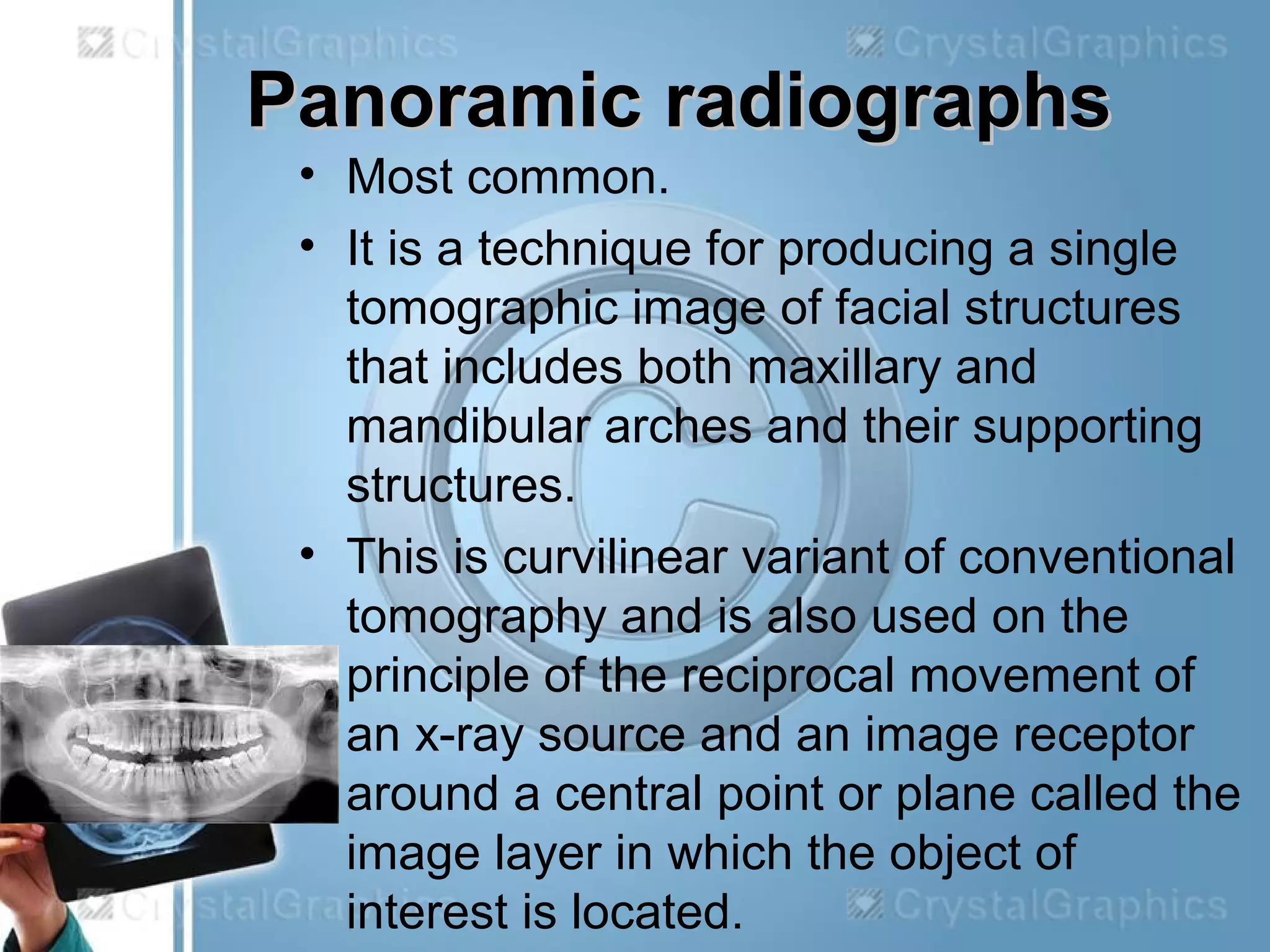 Extraoral radiography | PPT