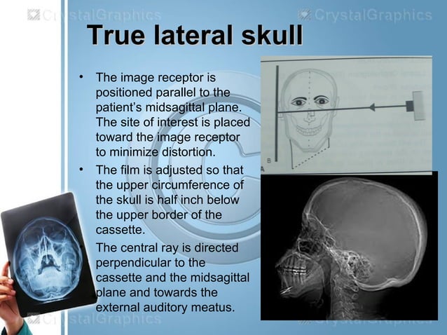 Extraoral radiography | PPT | Dental Health | Diseases and Conditions