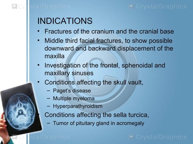 Extraoral radiography | PPT | Dental Health | Diseases and Conditions